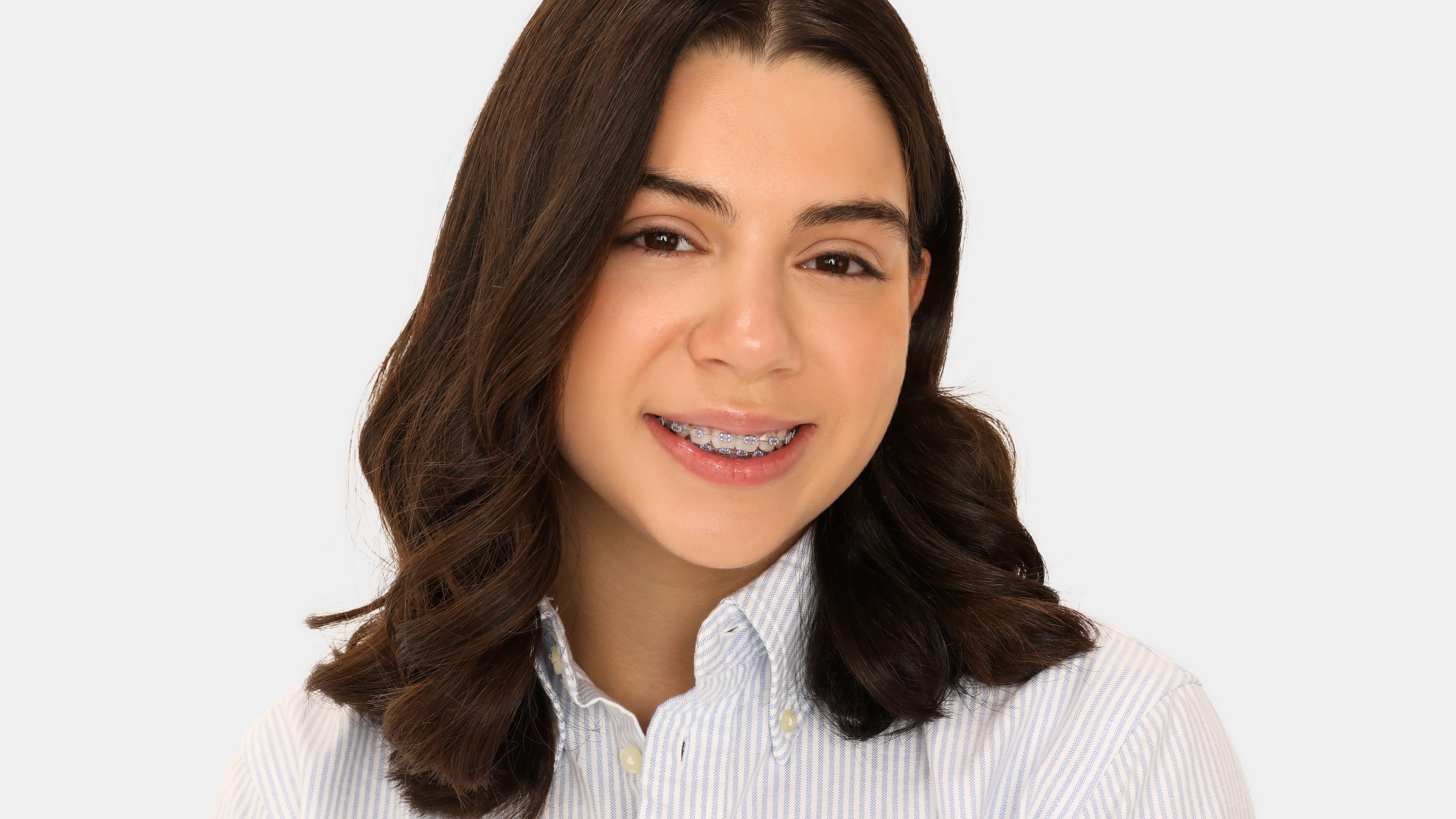 The Evolution of Braces: From Metal to Ceramic and Beyond